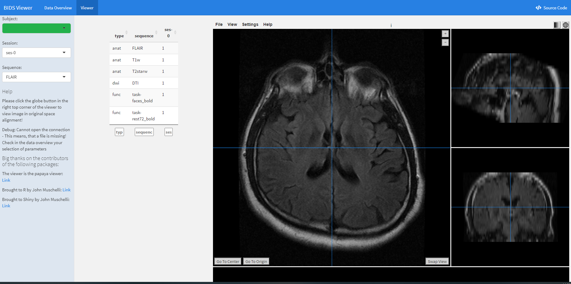 Start of the workflow — BIDSconvertR 0.0.1 documentation